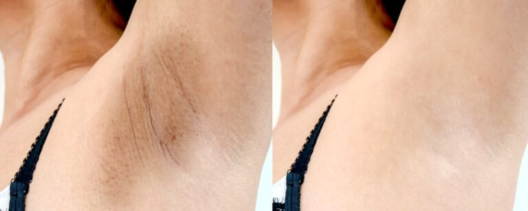 One Skin Clinic By K | Best Skin Clinic in Faridabad